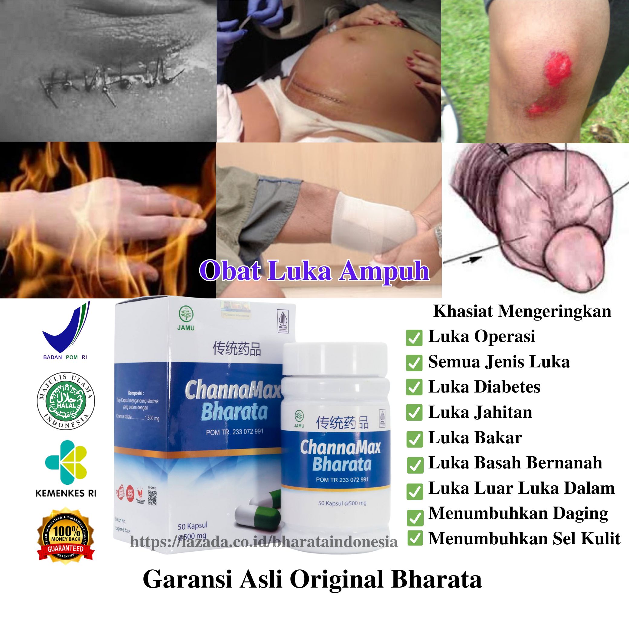 Obat Pengering Luka Ampuh Channamax Bharata Obat Penyembuh Luka Obat ...