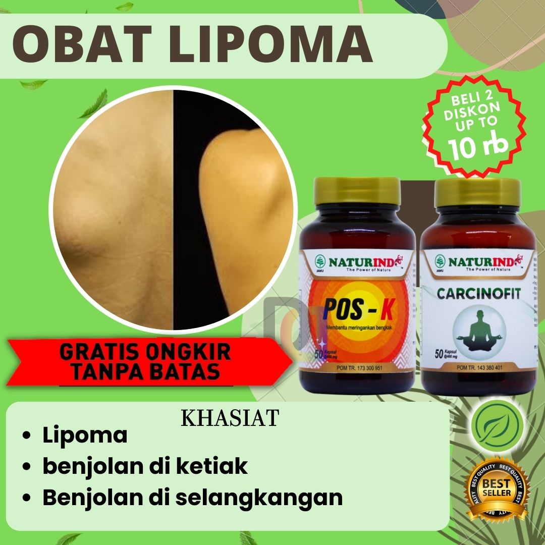 Obat lipoma benjolan lemak kapsul | Lazada Indonesia