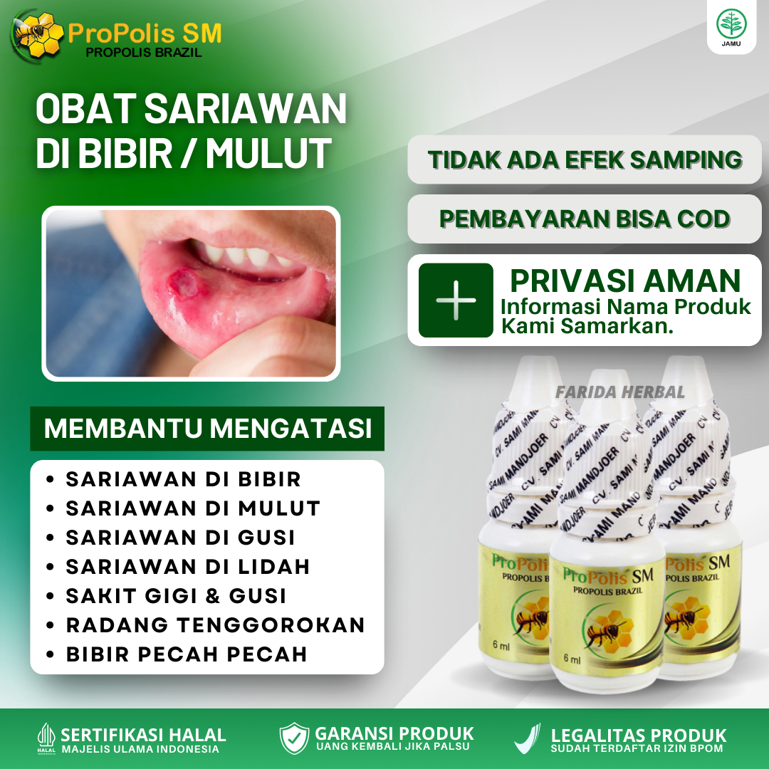 Obat Sariawan di Bibir Mulut Lidah Gusi Atasi Bau Mulut Tak Sedap Bibir ...
