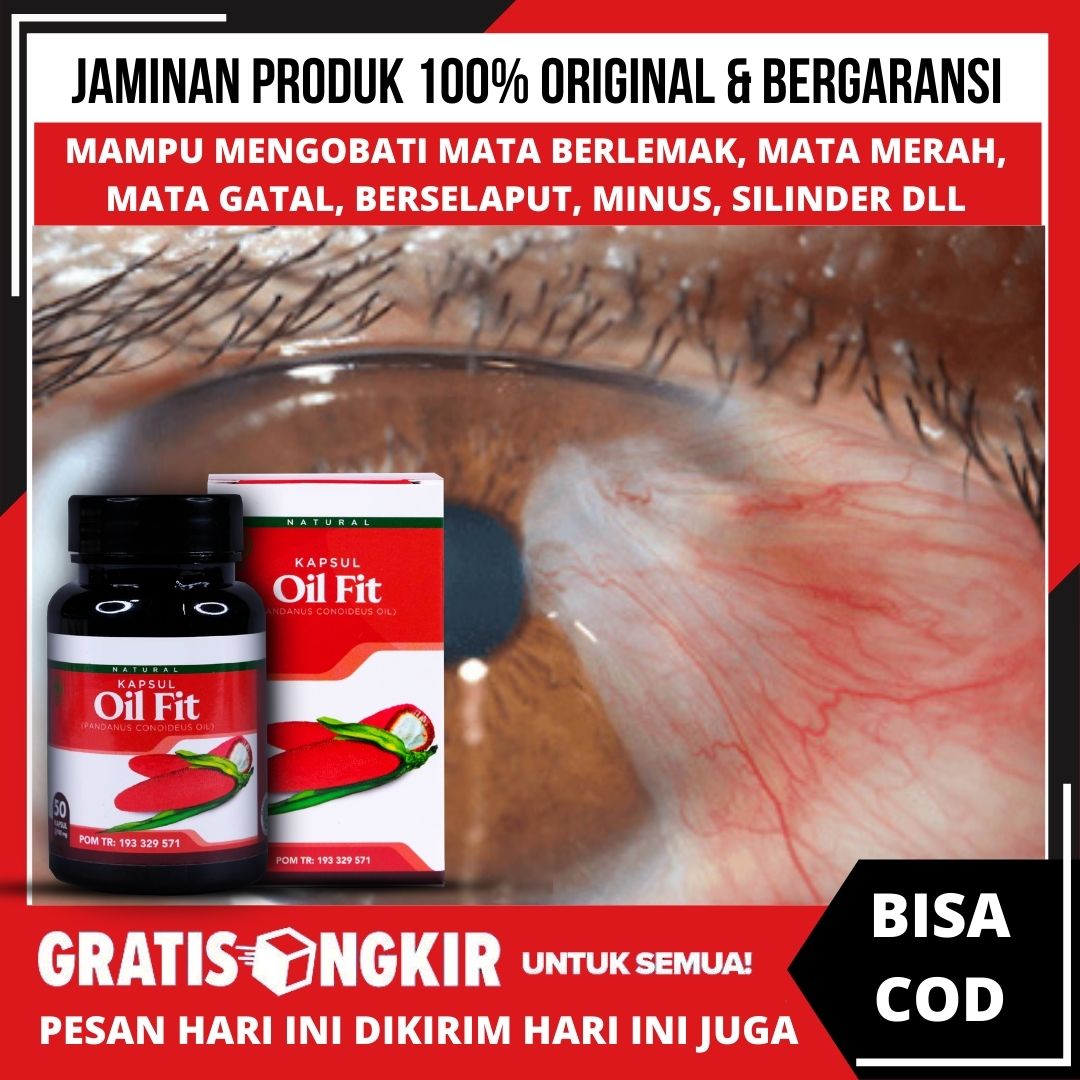 Obat Putih Putih Di Mata - Obat Pterygium - Obat Pterigium - Selaput ...