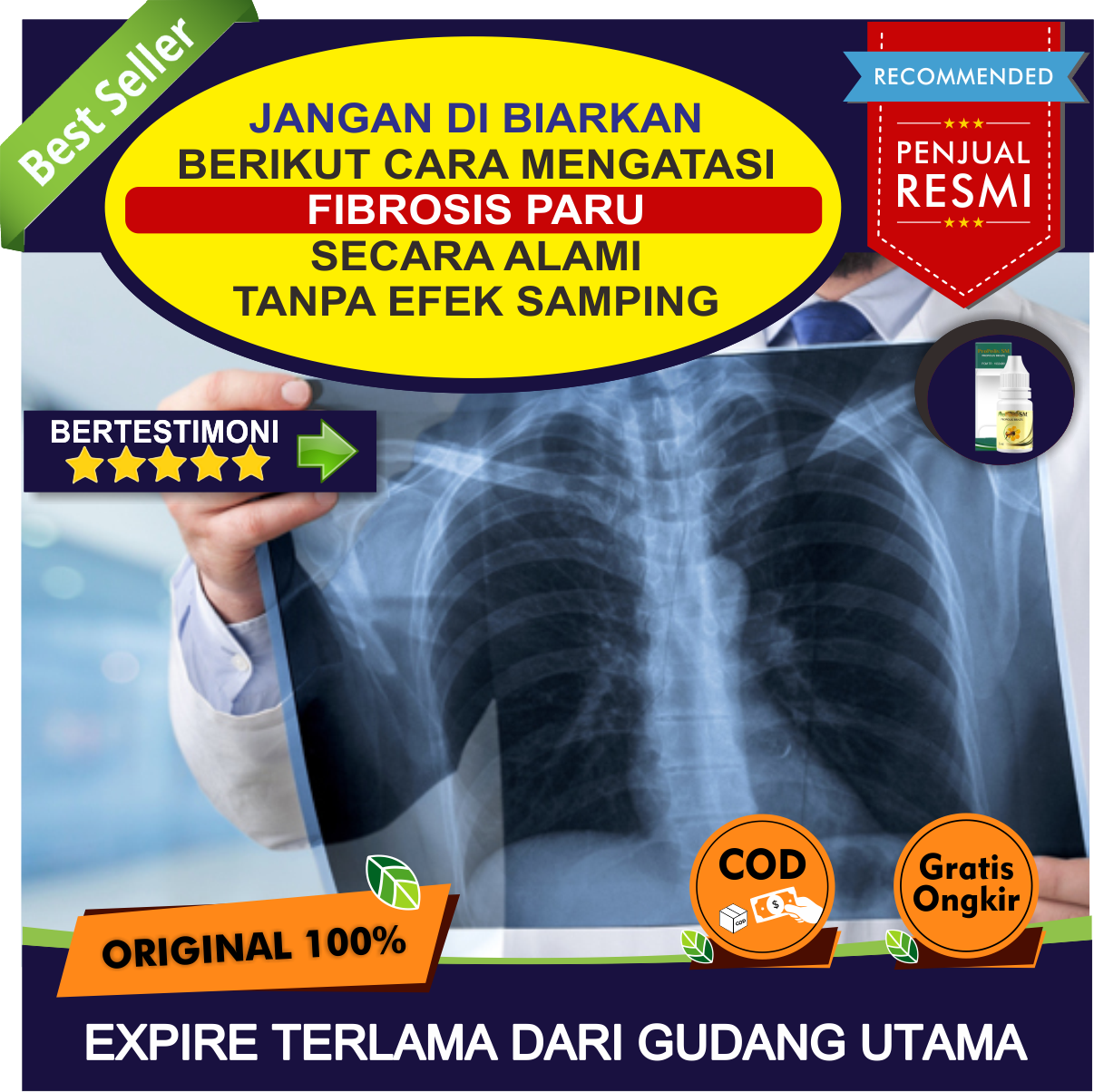 Obat Anti Fibrosis Paru Kanan, Obat Alami Untuk Fibrosis Paru, Obat ...