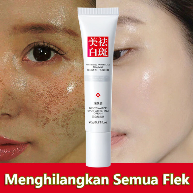 YOUBUY Whitening Freckle Cream Remove Dark Spots Anti Freckle Cream Niacinamide Fade ...
