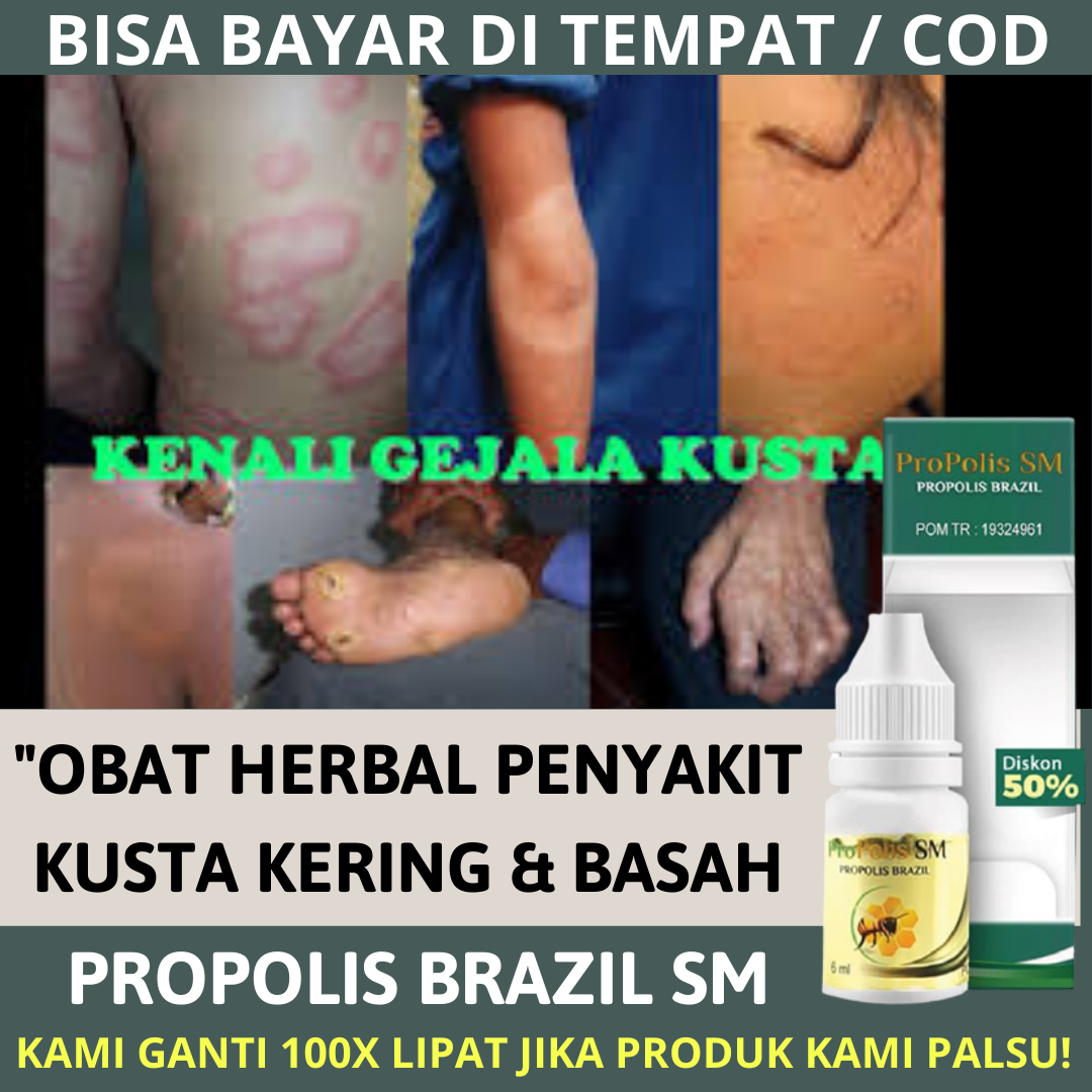Obat Kusta, Obat Penyakit Kusta - Mati Rasa - Lepra - Kusta Kering ...