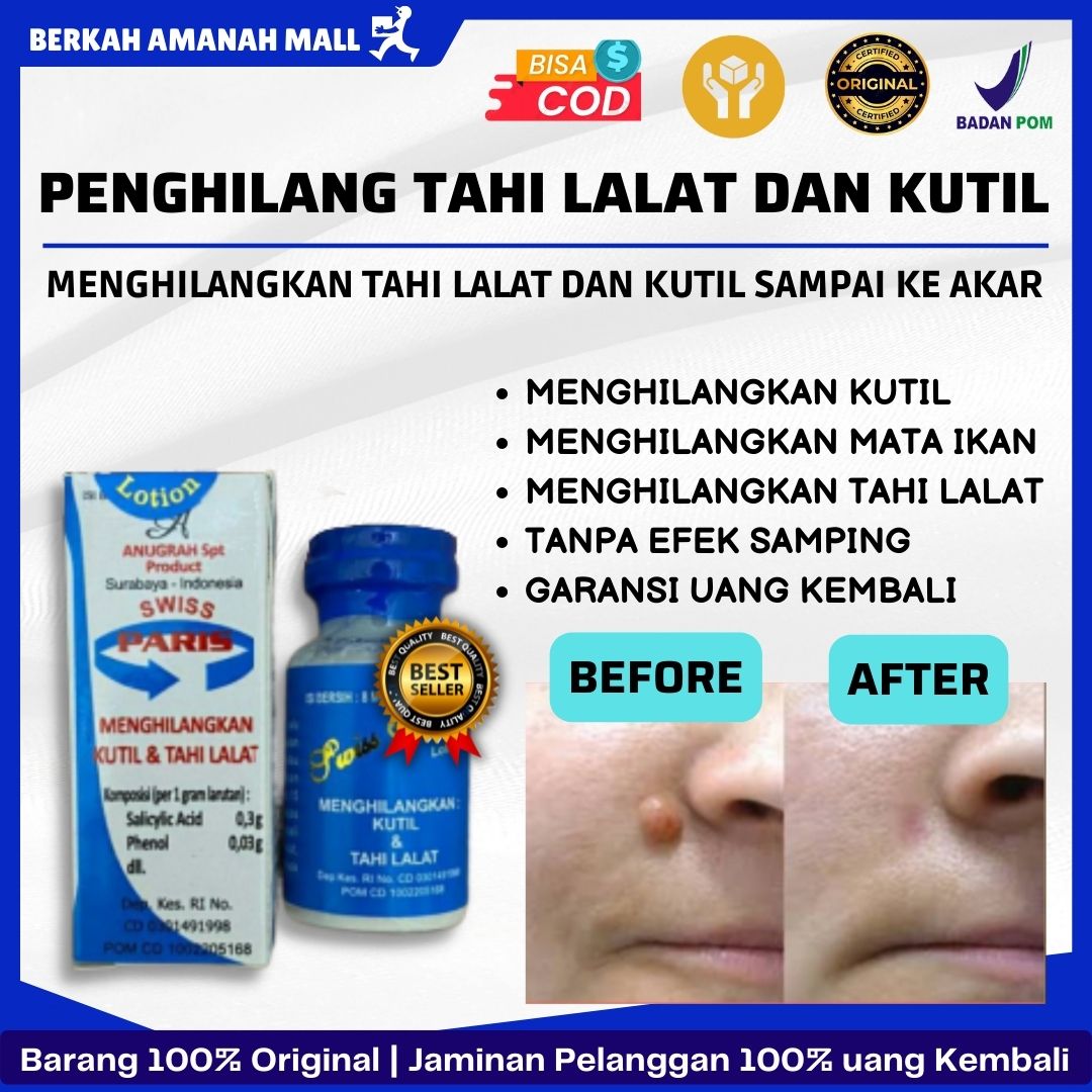 SWISS PARIS LOTION - Penghilang Tahi-lalat Dan Kutil Di Wajah Dan Badan ...
