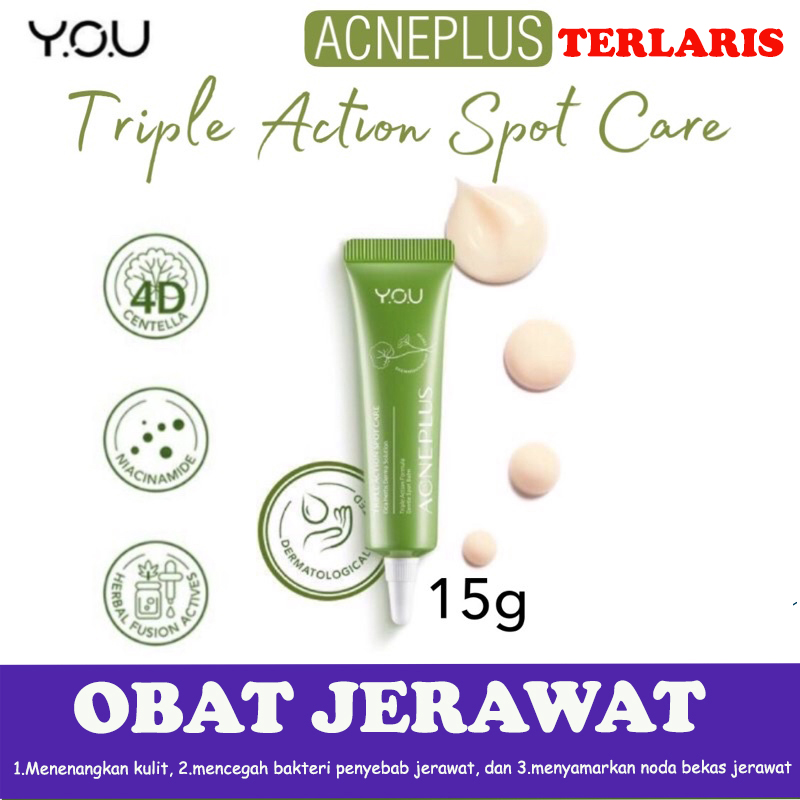 salep penghilang jerawat/obat jerawat/acne YOU/YOU jerawat-ORIGINAL ...