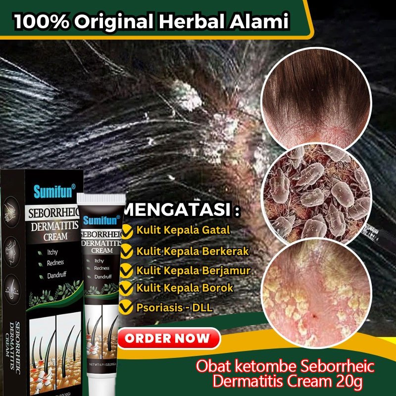 obat gatal kepala ketombe Obat Psoriasis Parah Gatal Kulit Kepala Jamur Kulit Kepala Borok di ...