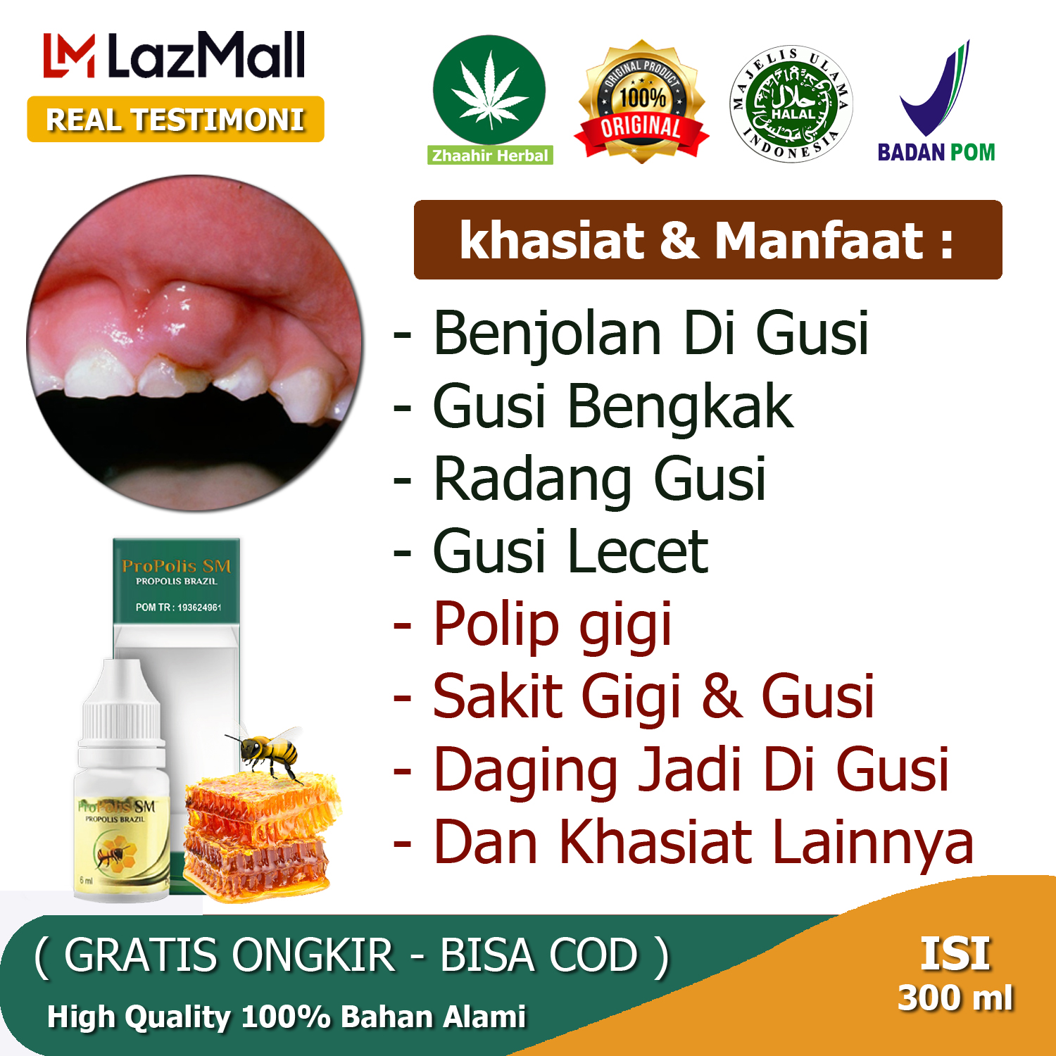 Obat Penghilang Benjolan Di Gusi Bengkak Radang Gusi Pengecil Daging ...