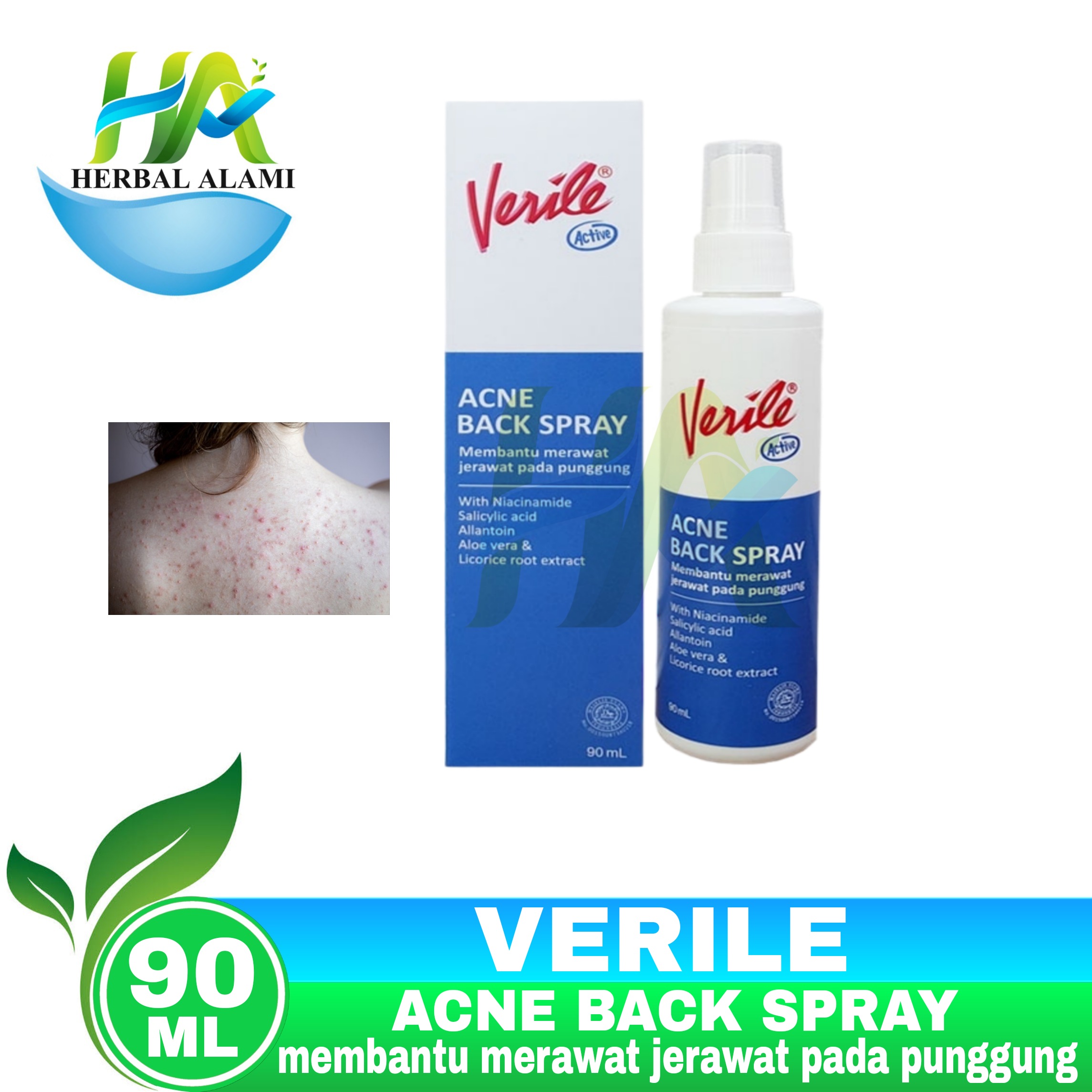Verile Acne Gel - Acne Blemish - Facial Wash | Lazada Indonesia
