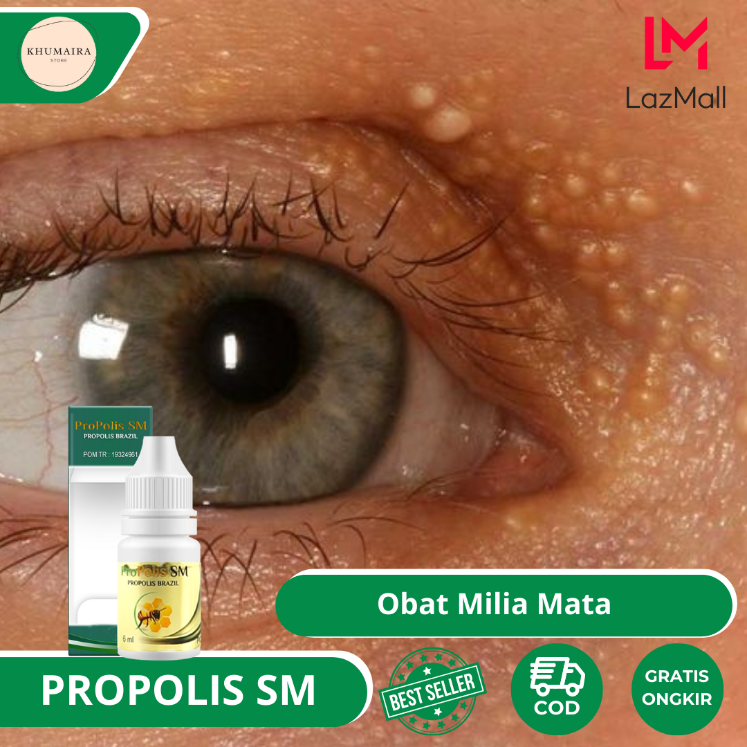 Obat milia di area mata, Milia pada wajah, milia di bawah mata, Obat ...