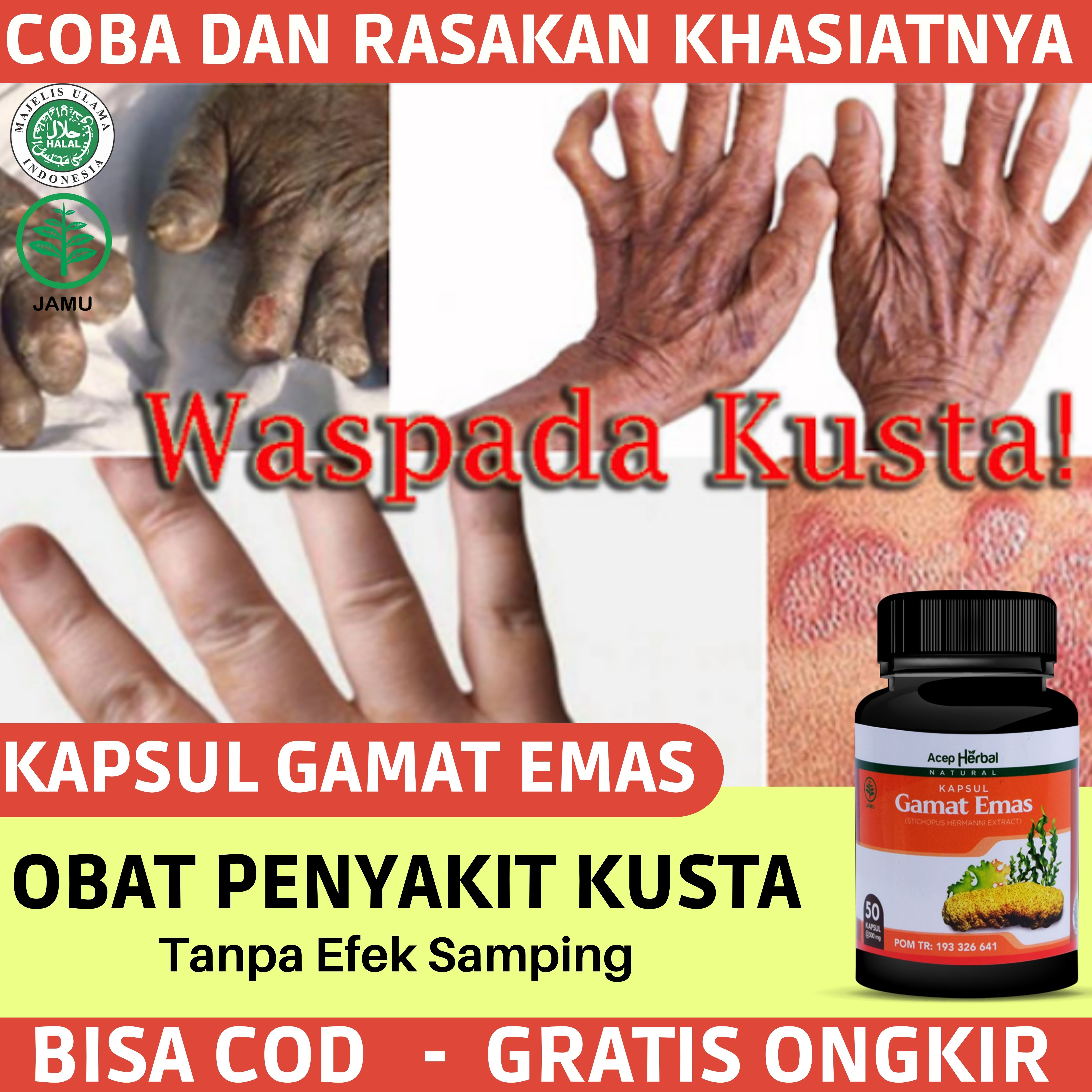 KAPSUL GAMAT EMAS Obat Penyakit Kusta Kering Basah Infeksi Jamur ...