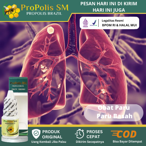 Obat Penyakit Paru Paru Basah, Asma, Tuberkulosis, Obat Gangguan ...