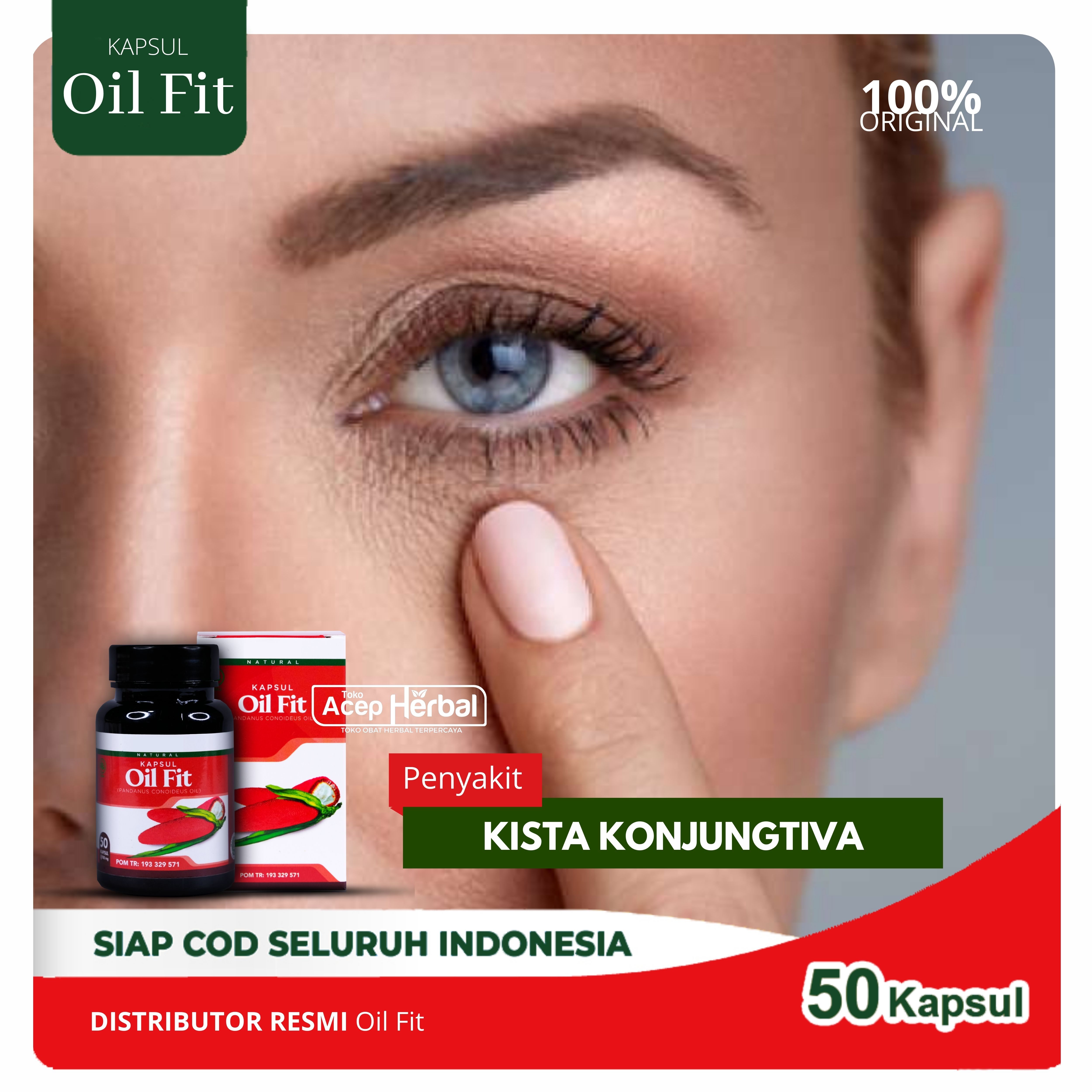 Obat Kista Konjungtiva, Benjolan Kista Di Mata - OilFit 50 Kapsul Acep ...