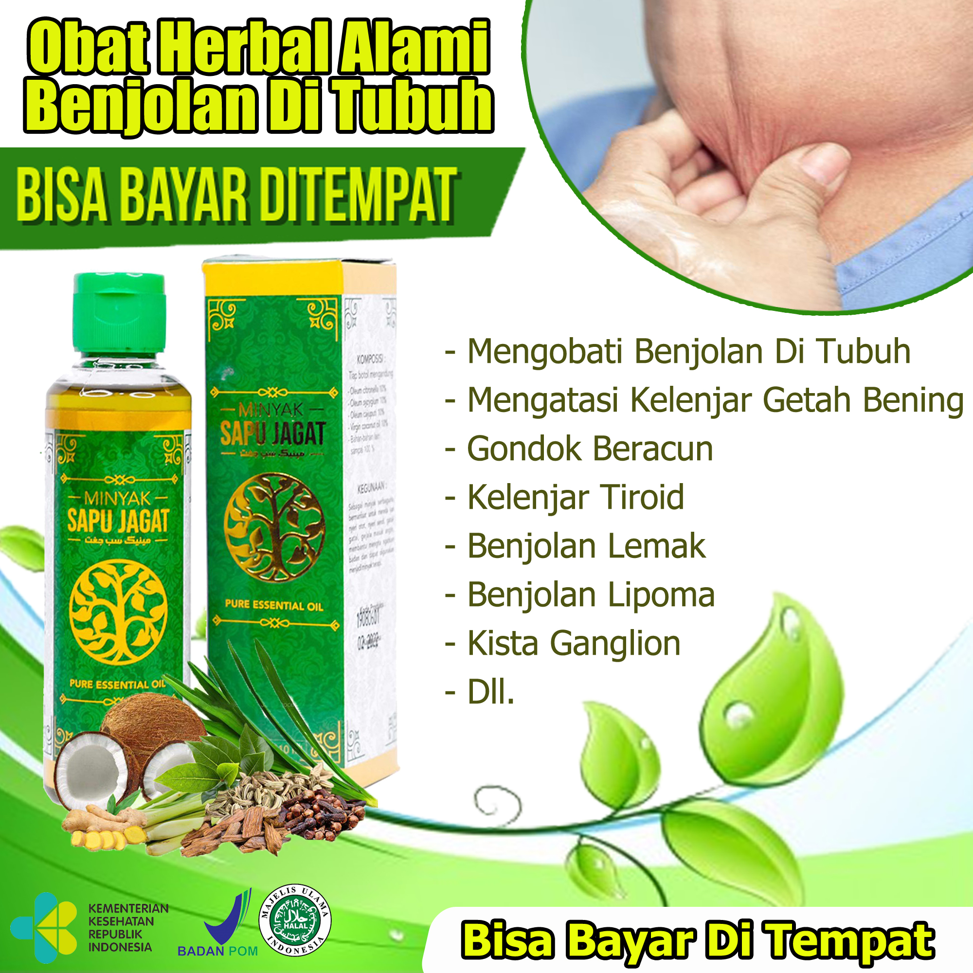 Obat Gondok Di Leher Kelenjar Tiroid Hipertiroid Penghilang Gondok ...