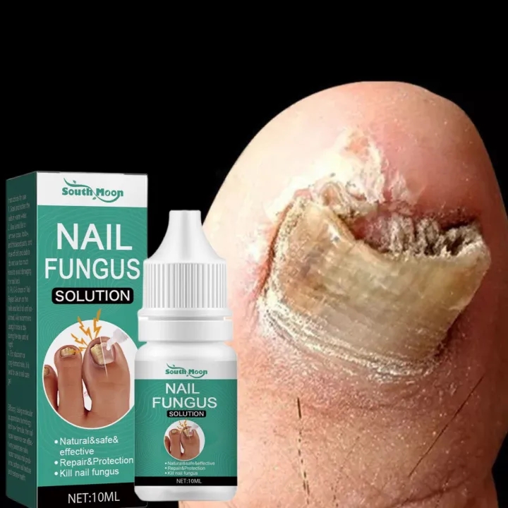 Nail Treatment Feet Care Essence Nail Foot Whitening Toe Nail Fungus ...