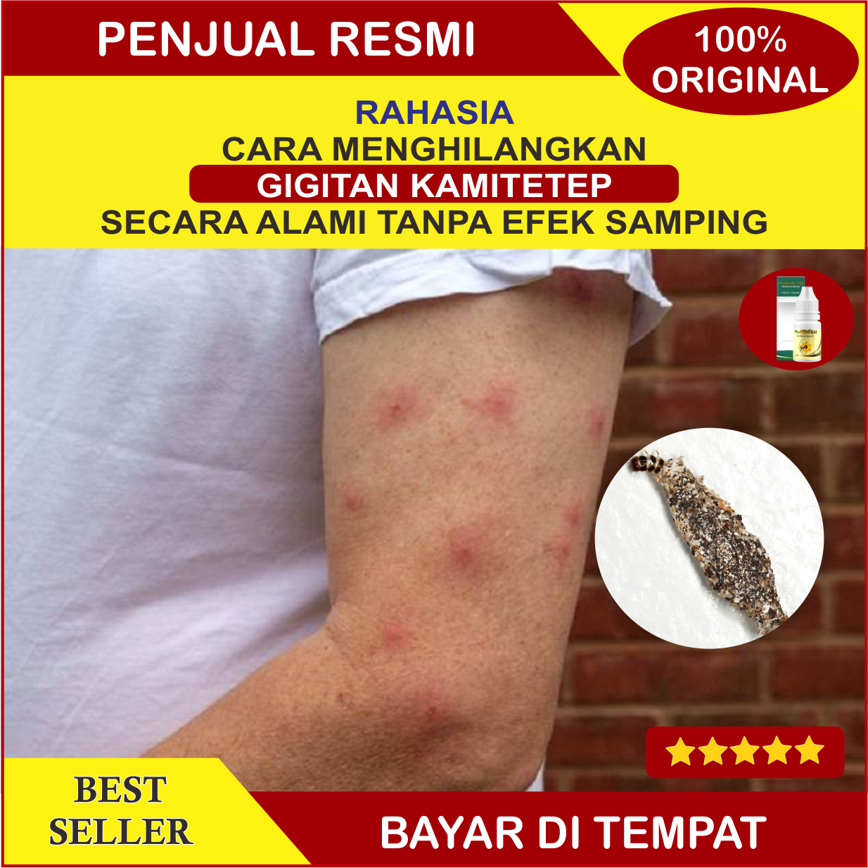 Salep Gatal Kena Serangga Kamitetep, Salep Gigitan Kamitetep, Salep ... Salep Gatal Kena Serangga Kamitetep, Salep Gigitan Kamitetep, Salep ...