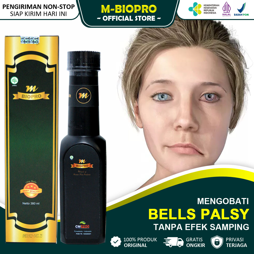 Obat Bells Palsy Paling Ampuh, Bells Palsy Alami, Bells Palsy Menahun ...