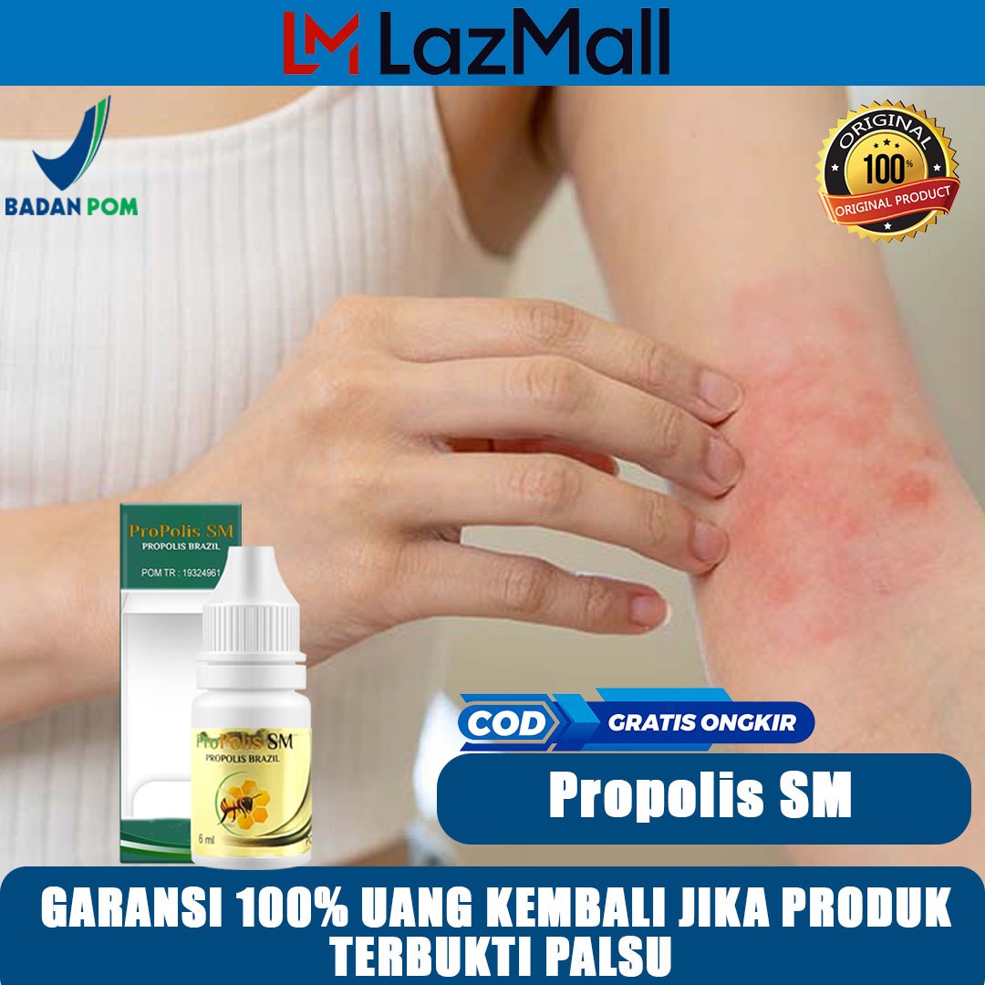 Obat Cenang Bernanah, Obat Scabies Manusia, Cacar, Gatal Gatal, Borok ...