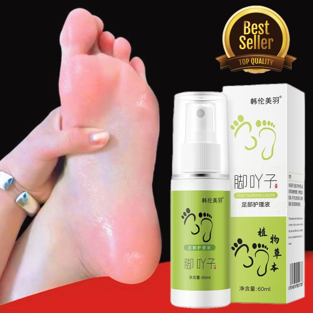 Anti-Fungal Spray Fungal Combat Feet Spray 60ml, Anti Fungal Infections ...