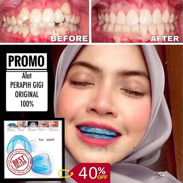 Lagi Promo kawat gigi transparant Trainer Alignment Orthodontic Retainer Alat Perapih Gigi Warna ...