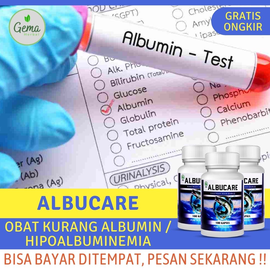 Obat Tubuh Kekurangan Albumin - Hipoalbuminemia, Kaki Bengkak Edema ...