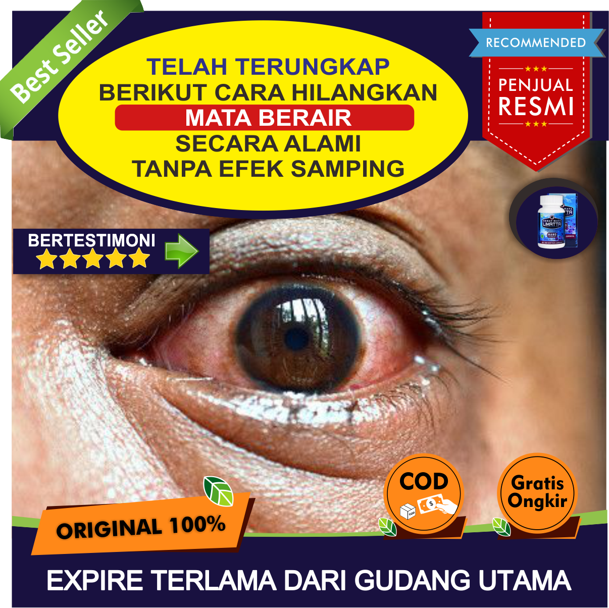 Obat Mata Perih Dan Berair, Obat Mata Berair Rabun, Obat Mata Berair ...