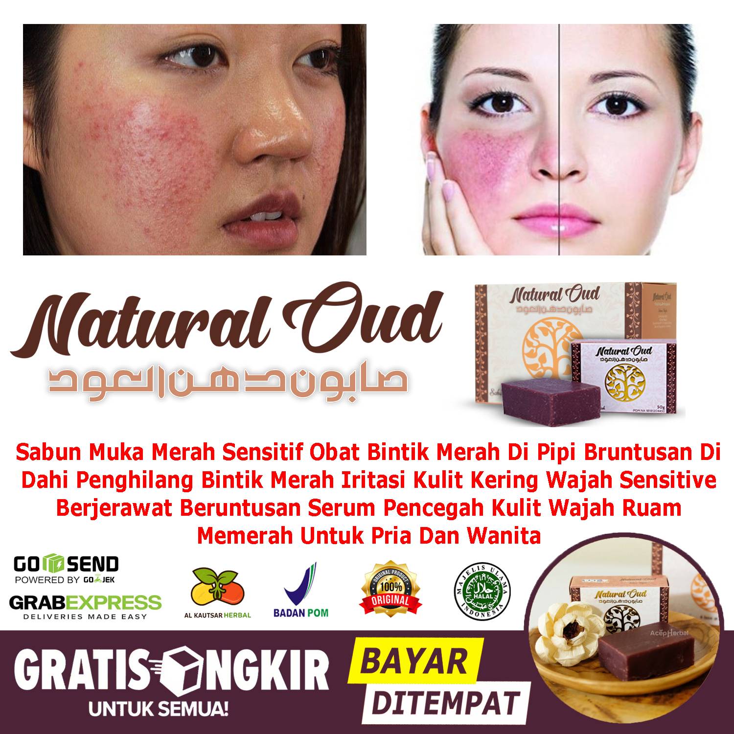 Sabun Muka Merah Sensitif Obat Bintik Merah Di Pipi Bruntusan Di Dahi ...