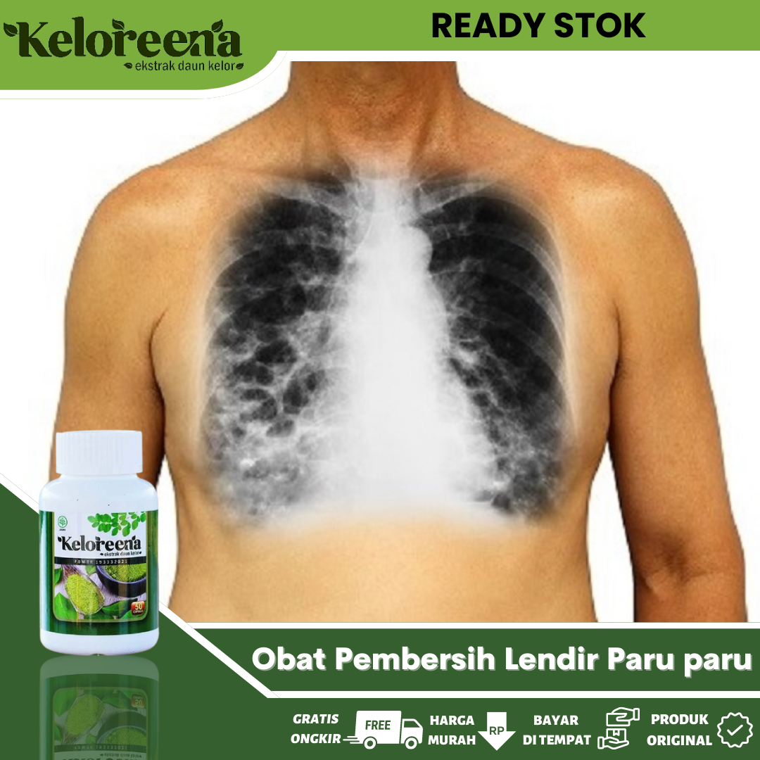 Obat Pembersih Lendir Paru Paru, Gurah Lendir Paru Paru, Obat Paru Paru ...