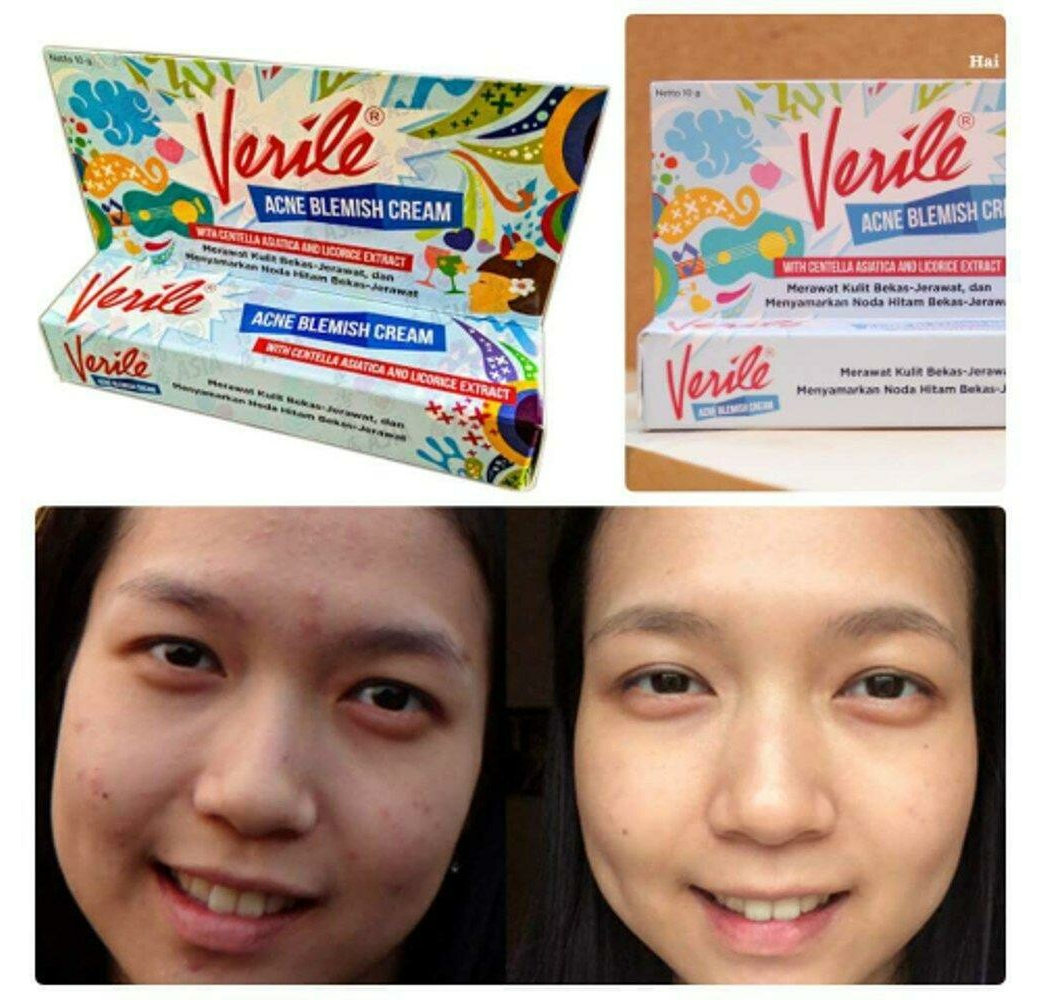 VERILE Veril Acne Gel 10 gr Care Facial wash 40ml Acne Blemish Cream ...