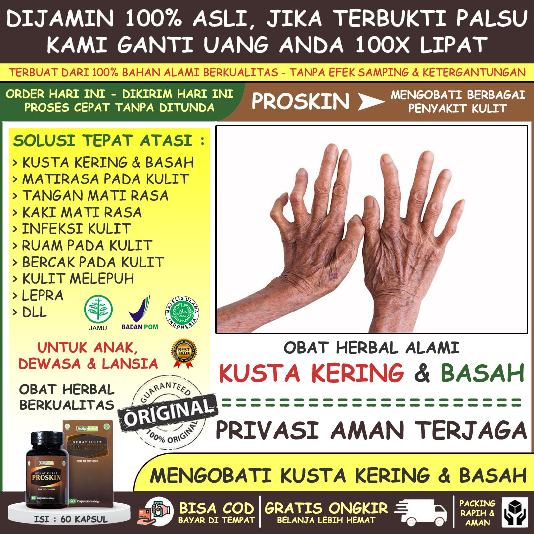 Obat Kusta Kering Matirasa Pada Kulit Tangan Dan Kaki Penyakit Lepra ...