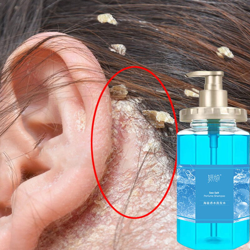 500ml SEA SALT Sampo Anti Ketombe Dan Gatal Sampo Garam Laut, Anti Gatal Anti Ketombe ...