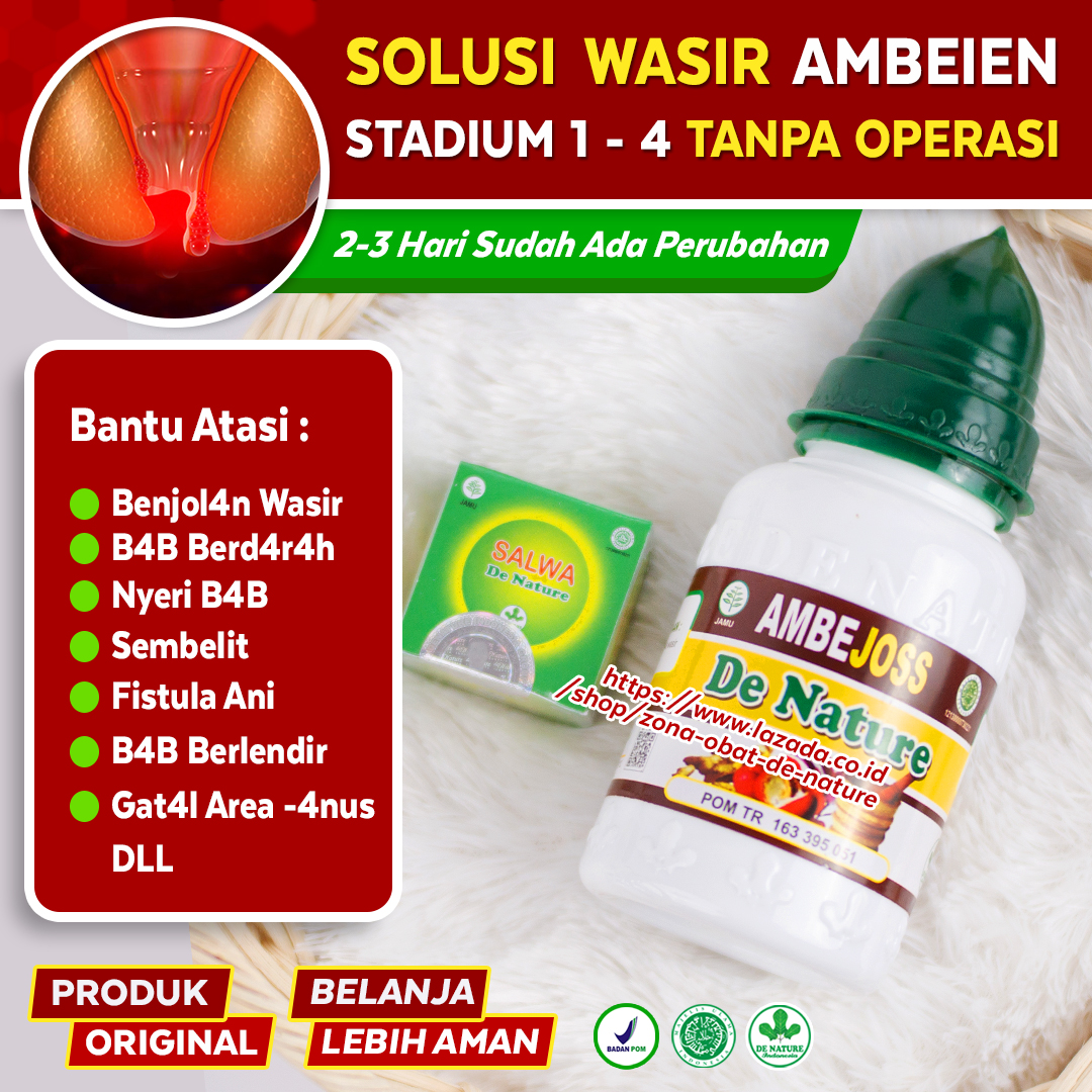 Obat Wasir Ambeien Ambeyen Keluar Benjolan Luar Dalam Stadium 4 Paling ...