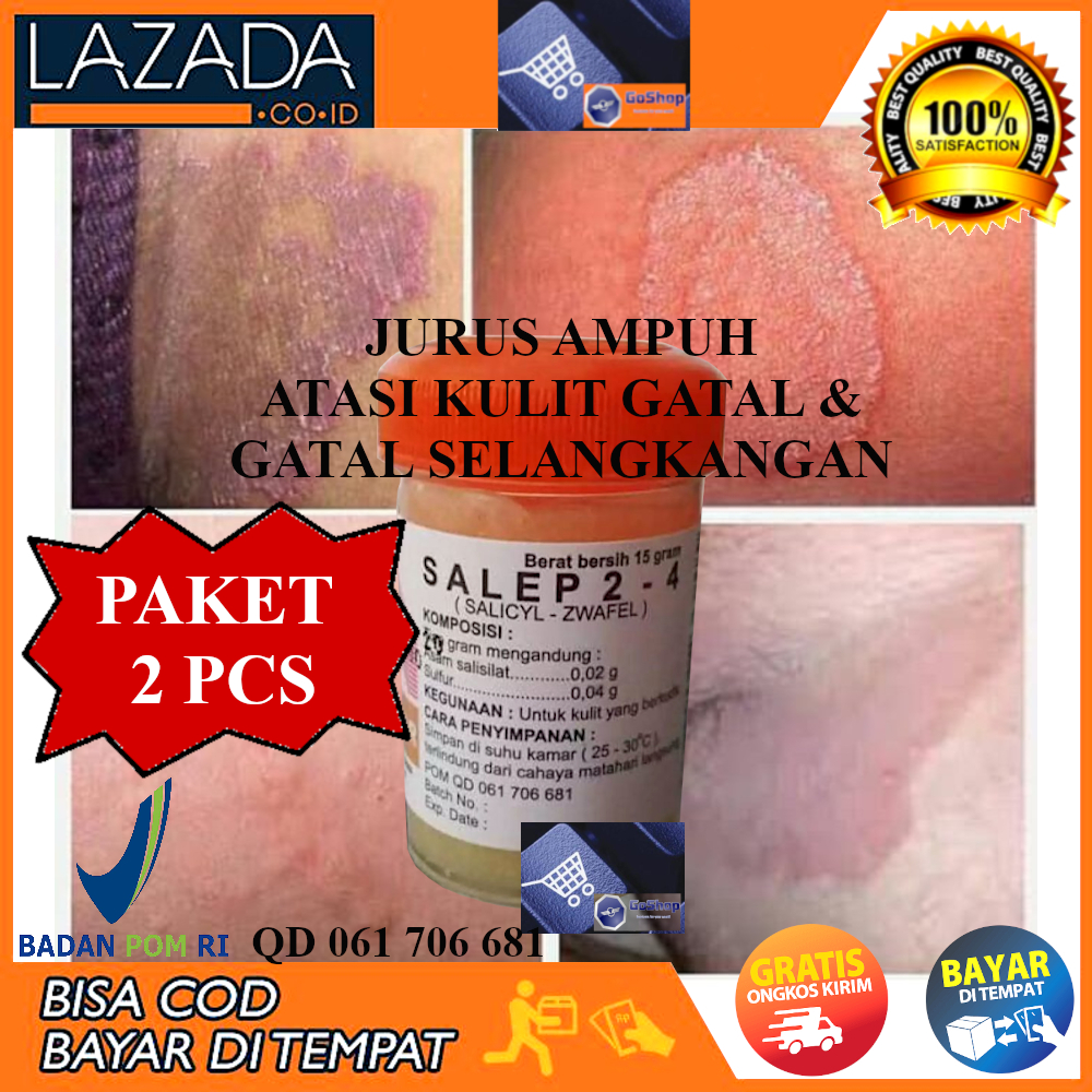 PAKET 2 PCS Salep Gatal Zwafel 2 4 Ampuh Salep Kulit Gatal Akibat ...