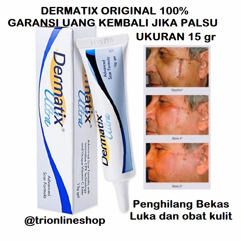 DERMATIX ULTRA GEL 15Gr ORIGINAL PENGHILANG BEKAS LUKA | Lazada Indonesia