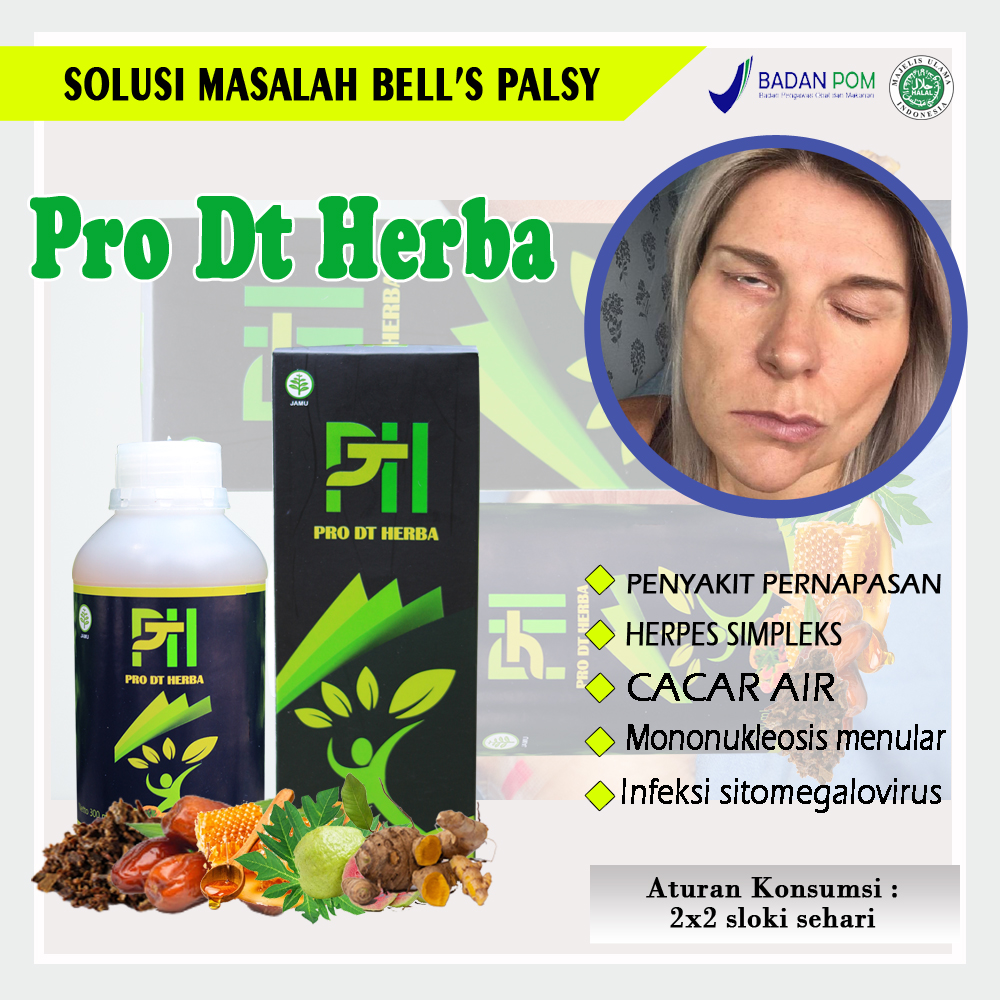 Obat Bells Palsy Paling Ampuh Obat Herbal Bells Palsy Obat Untuk Bells Palsy Obat Stroke Muka