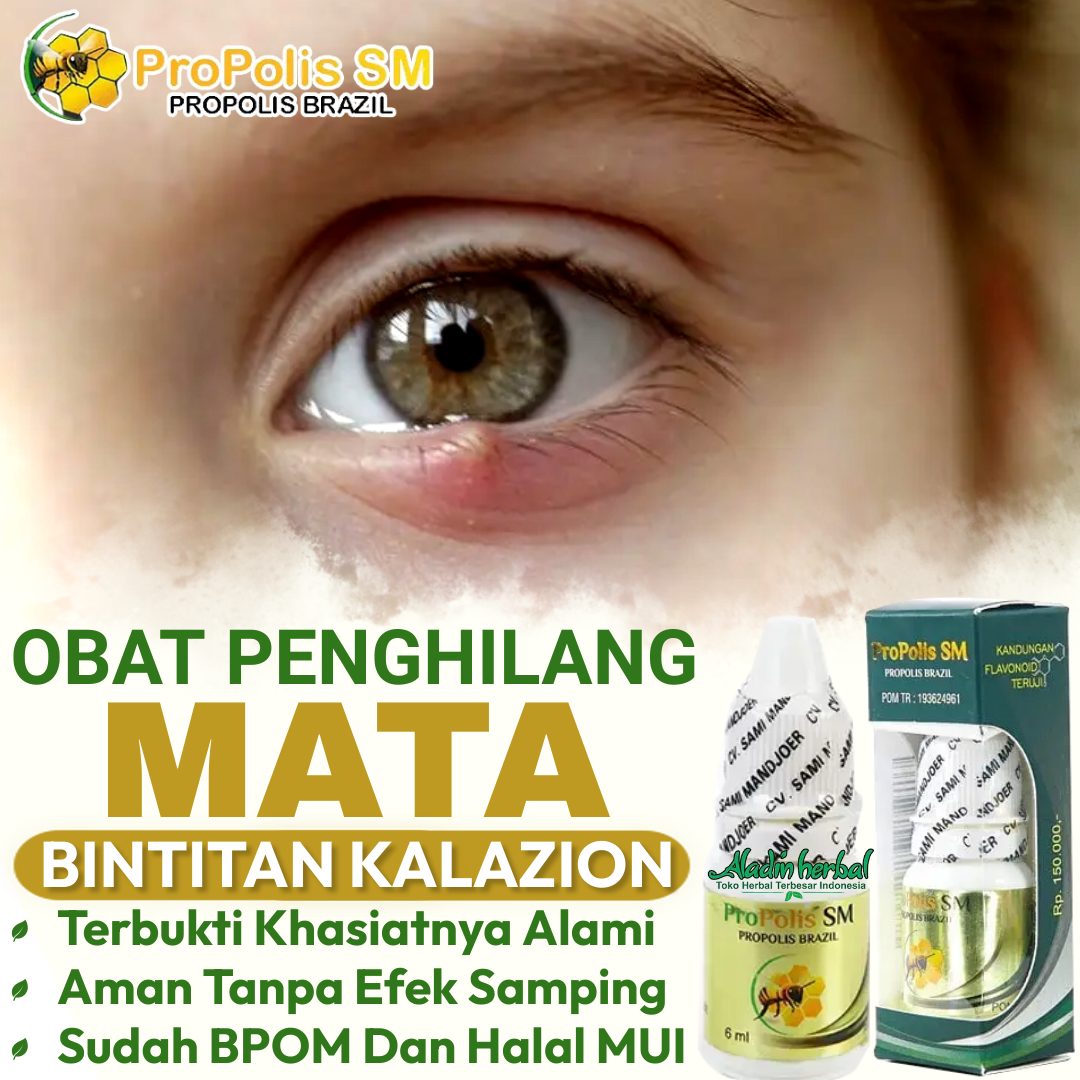 Obat Bintitan Di Kelopak Mata - Obat Mata Kalazion - Obat Penghilang ...