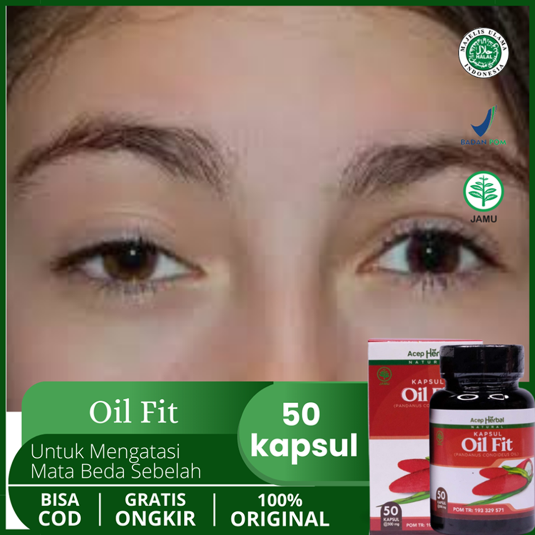 Obat Mata Beda Sebelah Sipit Sebelah Kelopak Mata Turun Ptosis Mata Kecil Sebelah Mata