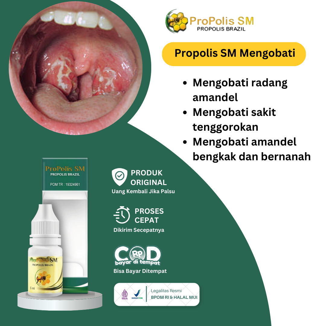 Obat Amandel, Obat Radang Amandel, Obat Sakit Tenggorokan, Obat Amandel ...