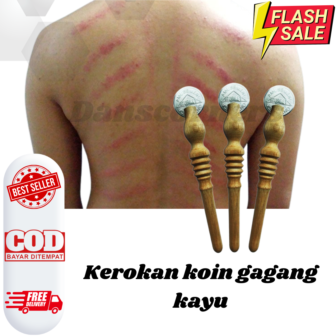Dans Corners - Kerokan Koin Gagang Kayu - Kerokan Koin Masuk Angin ...