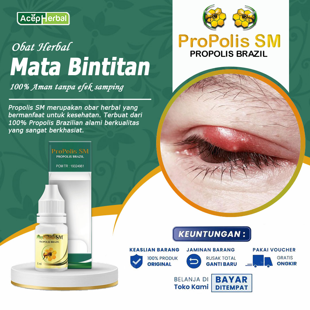 Obat Mata Bintitan Kalazion Pada Anak Dan Dewasa Mata Bengkak ...