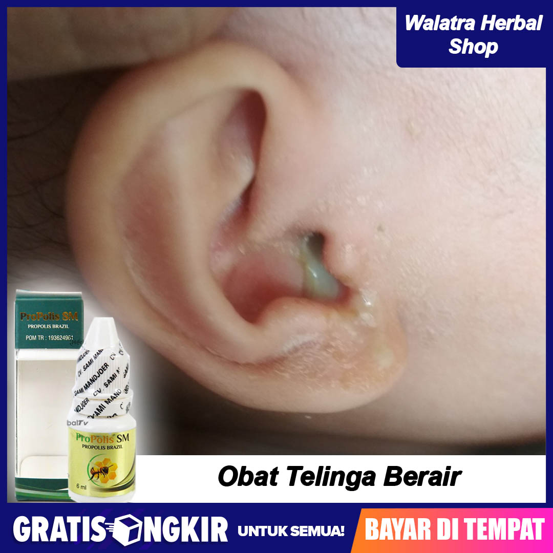 Obat Telinga Berair untuk Anak - Congek - Pembersih Kotoran Telinga ...