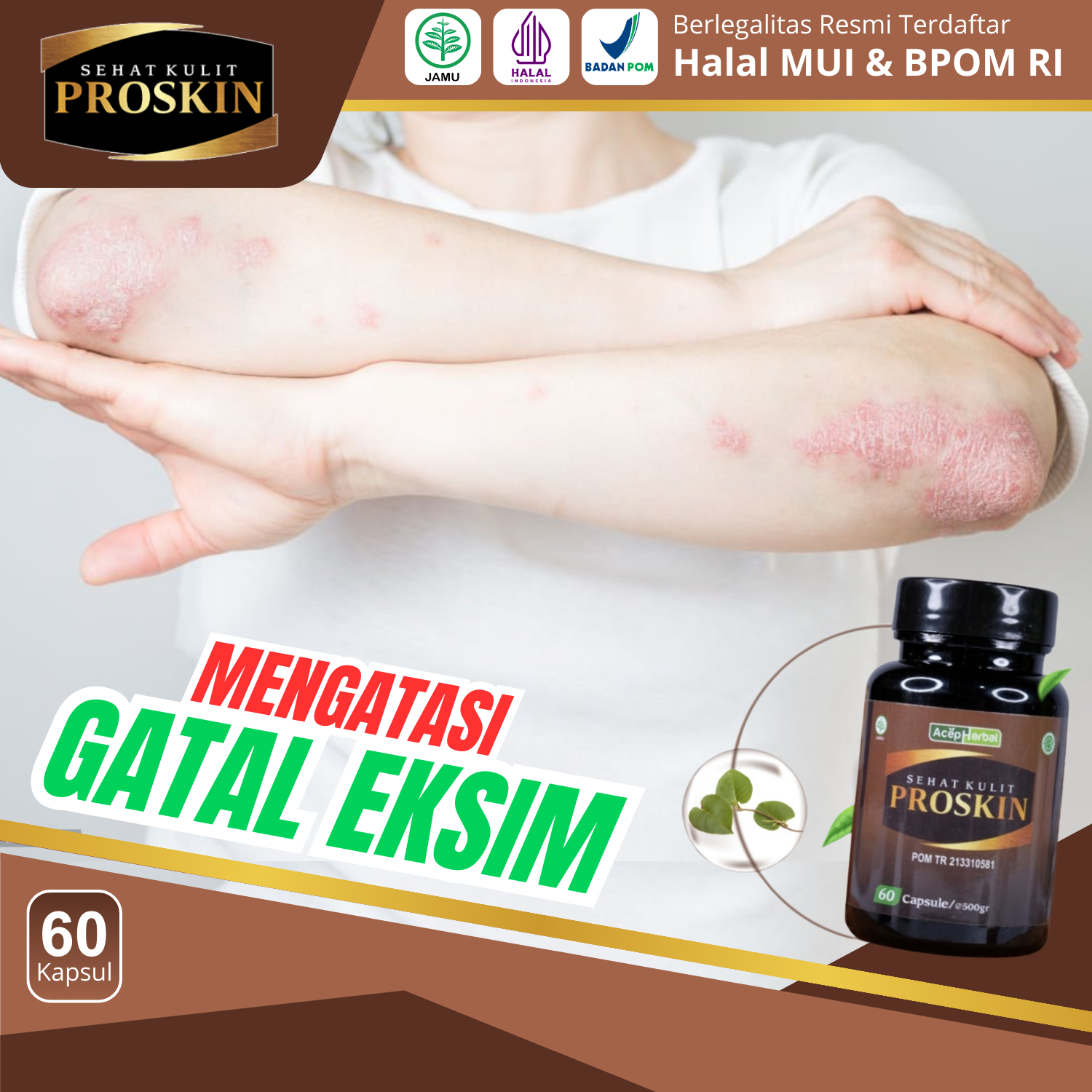 Obat Eksim Ruam Kulit Dermatitis Alergi Kulit Ekzema Kurap - Obat ...